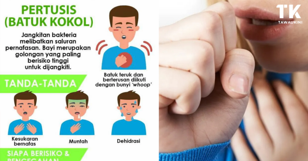 Tanda & gejala penyakit batuk kokol (Pertussis) - TawauKini